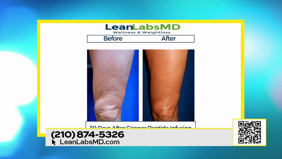 9175fefc-122e-423b-aecd-a8a348dbe147-large16x9_vlcsnap2023030917h08m45s123.jpg?1678403744577